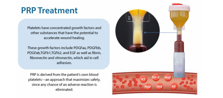 How Does PRP Work? - Advanced Pain Management Jacksonville Florida ...